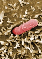 Yersinia pseudotuberculosis